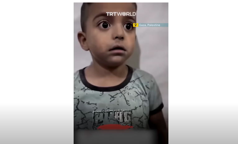 ДАН - (VIDEO) Potresan snimak iz Gaze: Doktor tješi dječaka nakon ... ДАН - (VIDEO) Potresan snimak iz Gaze: Doktor tješi dječaka nakon ...